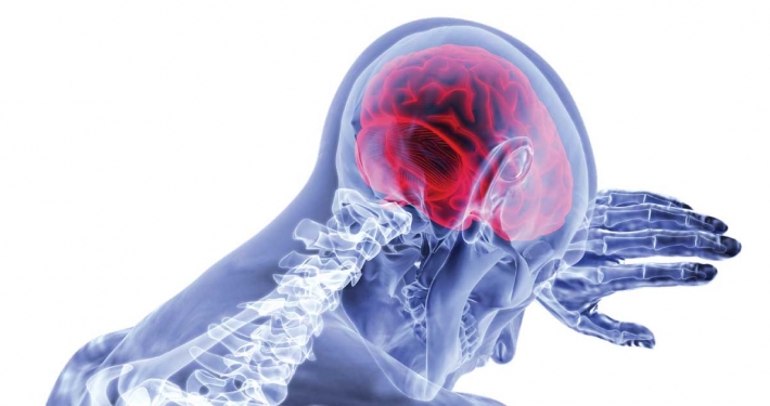 Identifying & Treating Neurotoxicity - The Kaplan Center : McLean, VA