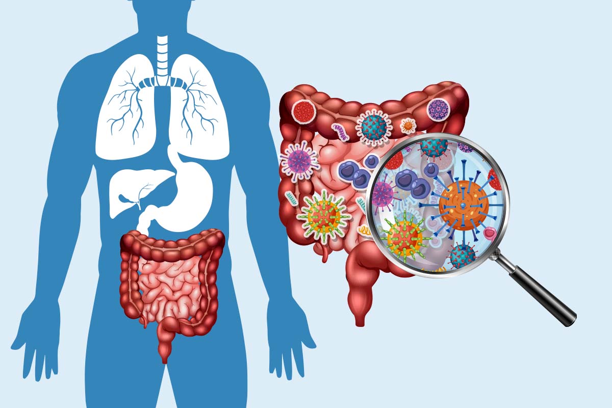Small Intestinal Bacterial Overgrowth (SIBO) - The Kaplan Center, McLean VA